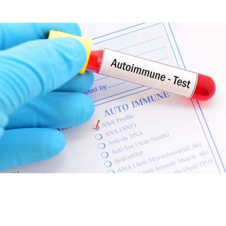 Autoimmune Diseases – What are they? Who gets them? - Dr. Lori Kalie